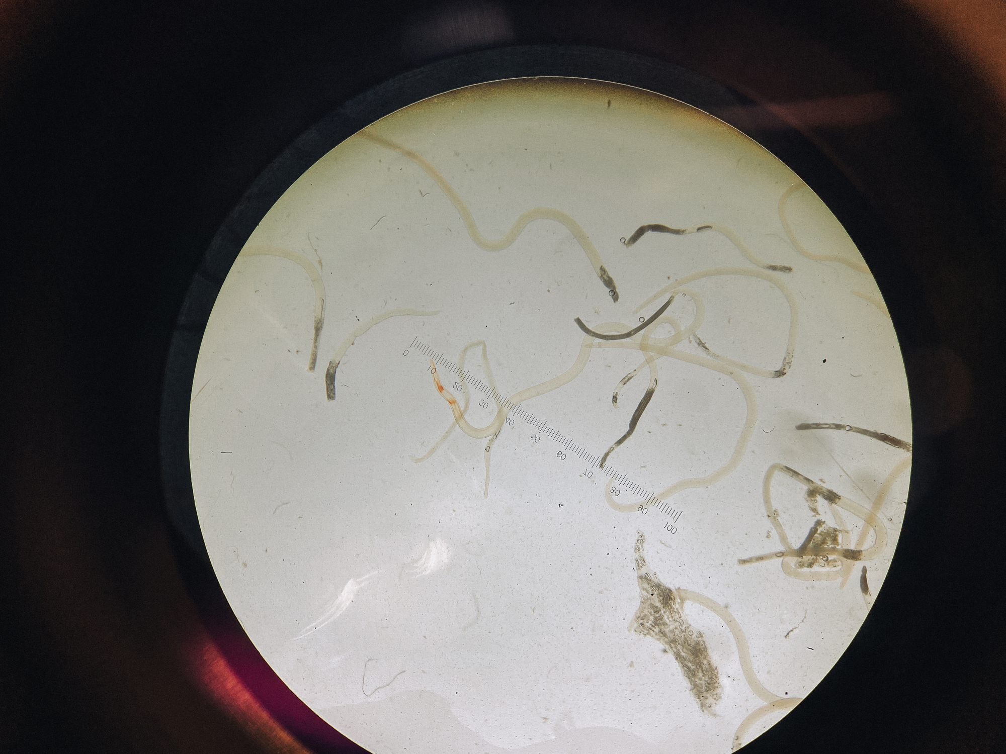 El anisakis | Blogs Quirónsalud