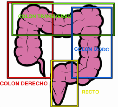 Cirugía en el cáncer de colon derecho. ¿Anastomosis intracorpórea o ...