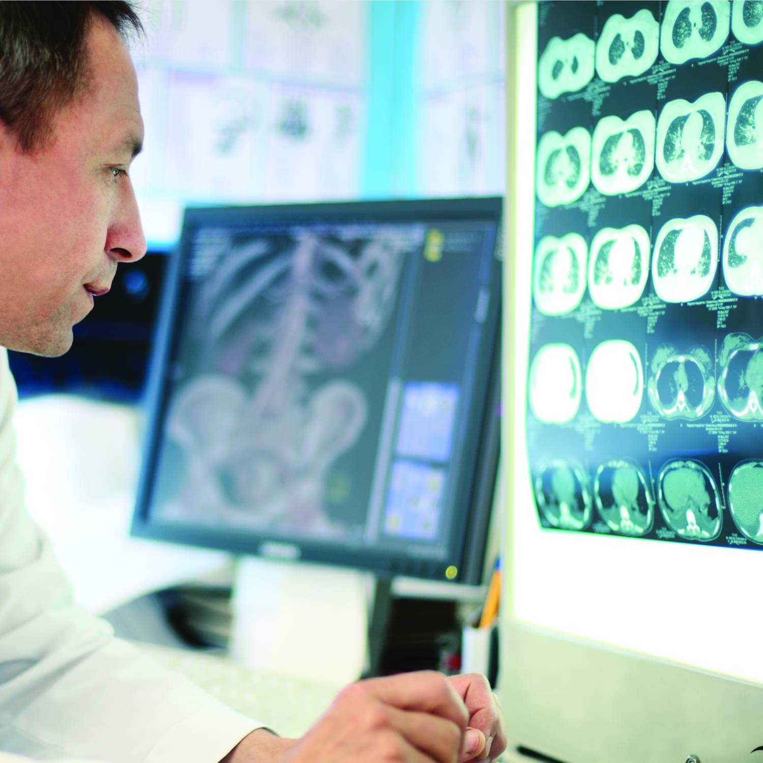 Los Danieles | Blogs Quirónsalud