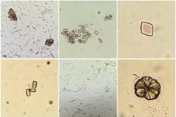 ¿Sabes lo que revela un análisis de orina? Parte II. Análisis rutinario ...