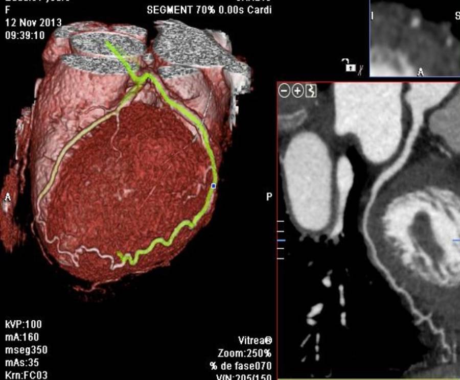 Pruebas diagnósticas | Hospital Quirónsalud Ciudad Real