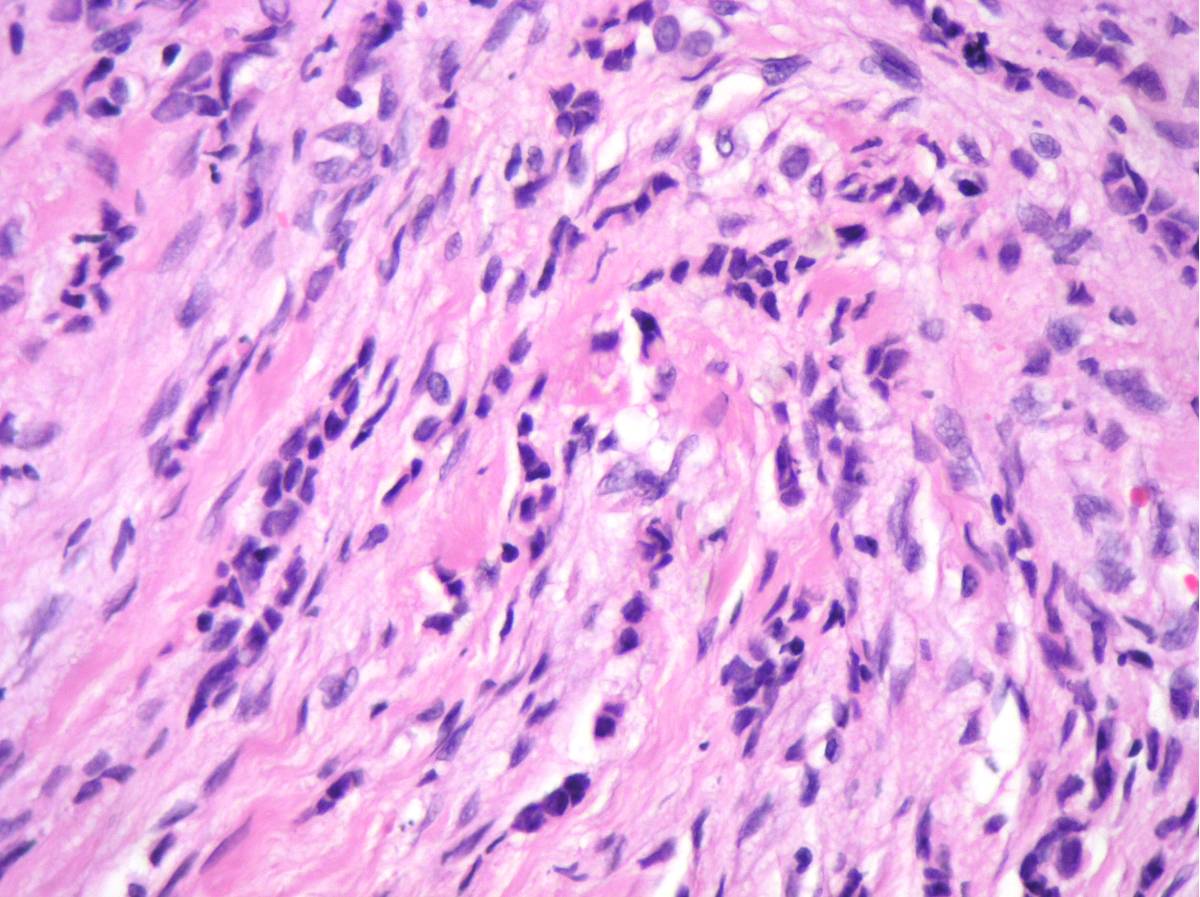 Els mecanismes «antirebuig» de la placenta podrien ser la clau per al ...