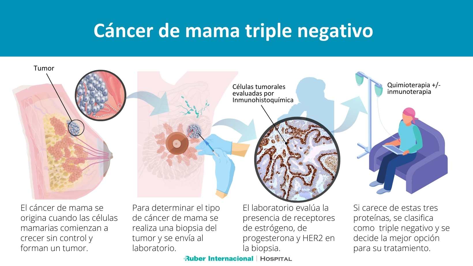 Tratamiento del cáncer de mama