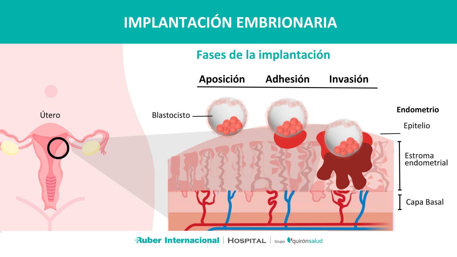 Evaluación funcional del Endometrio