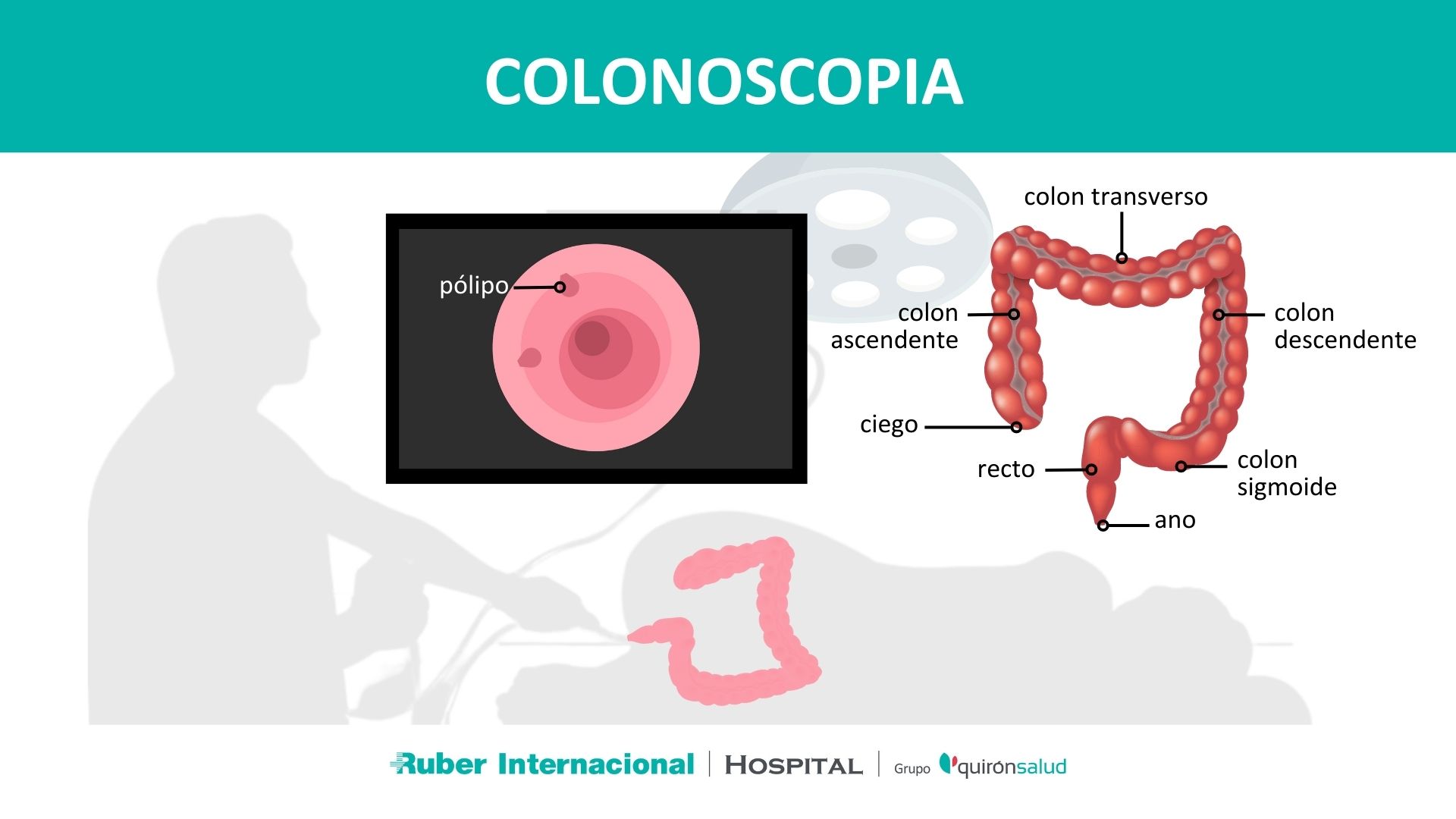 Cáncer de colon: La colonoscopia es una de las pruebas más sensibles y ...