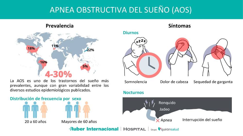 Apnea Obstructiva del Sueño (AOS): Causas y Síntomas frecuentes