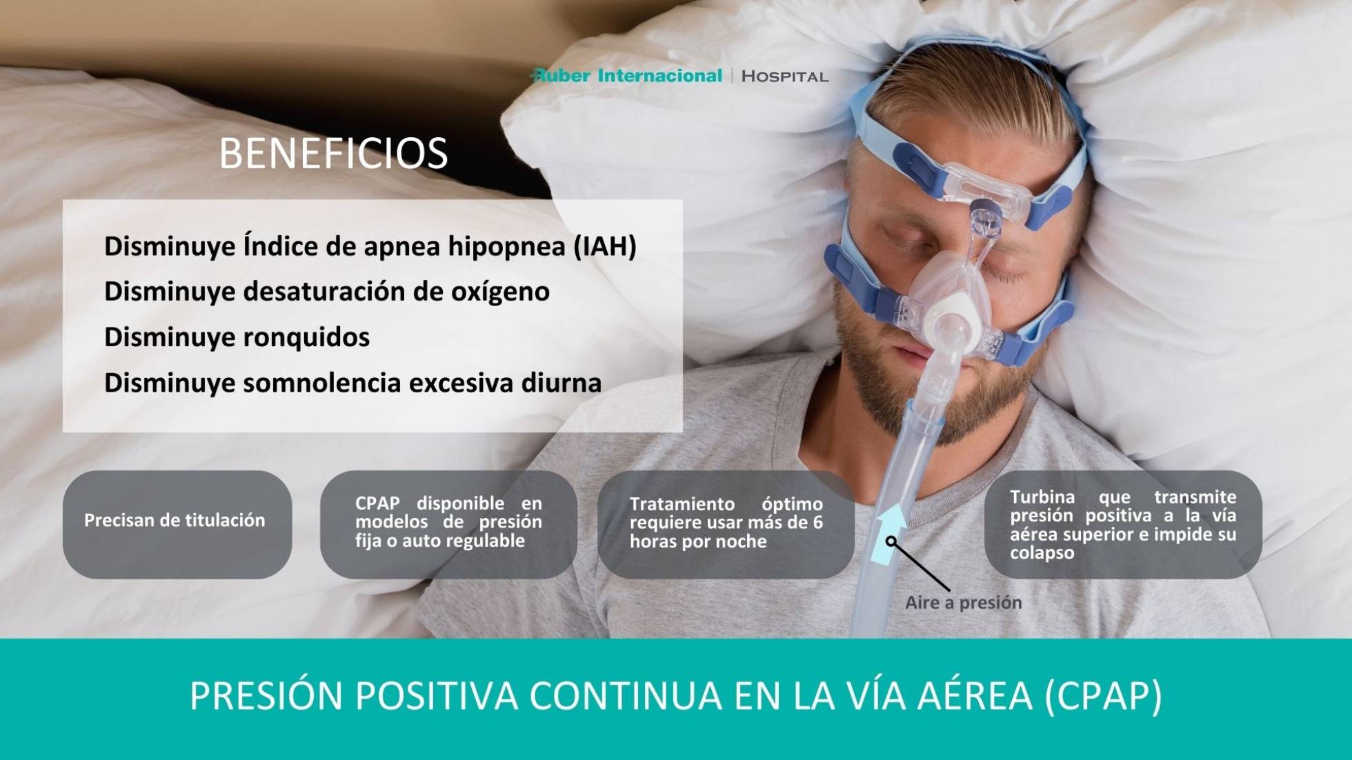 Tratamiento de la Apnea obstructiva del sueño (AOS)
