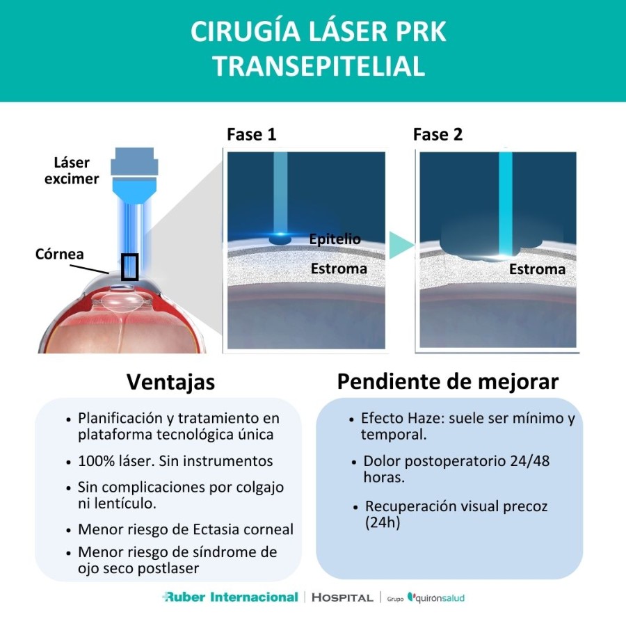Ventajas de la cirugía láser PRK transepitelial