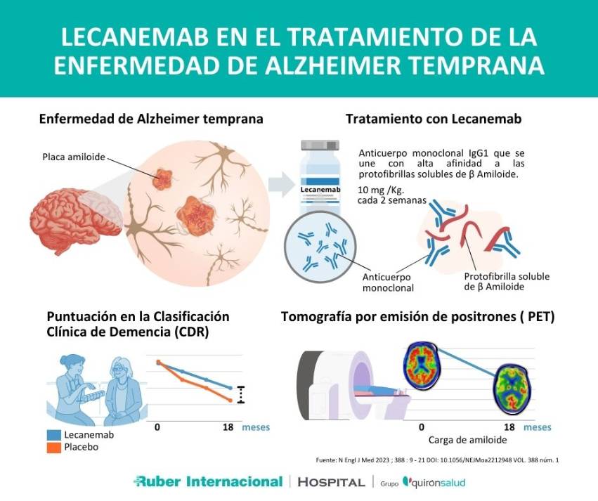 Lecanemab y Donanemab: Avances prometedores en el Tratamiento del Alzheimer