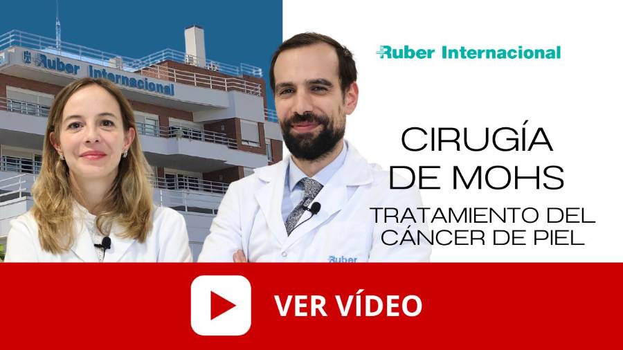 Cirugía de Mohs: Tratamiento del Carcinoma Basocelular en la piel de la ...