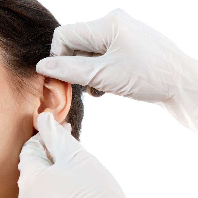 Lobuloplastia La Soluci n Definitiva A Tu L bulo Rasgado Quir nsalud lobuloplastia-la-soluci-n-definitiva-a-tu-l-bulo-rasgado-quir-nsalud