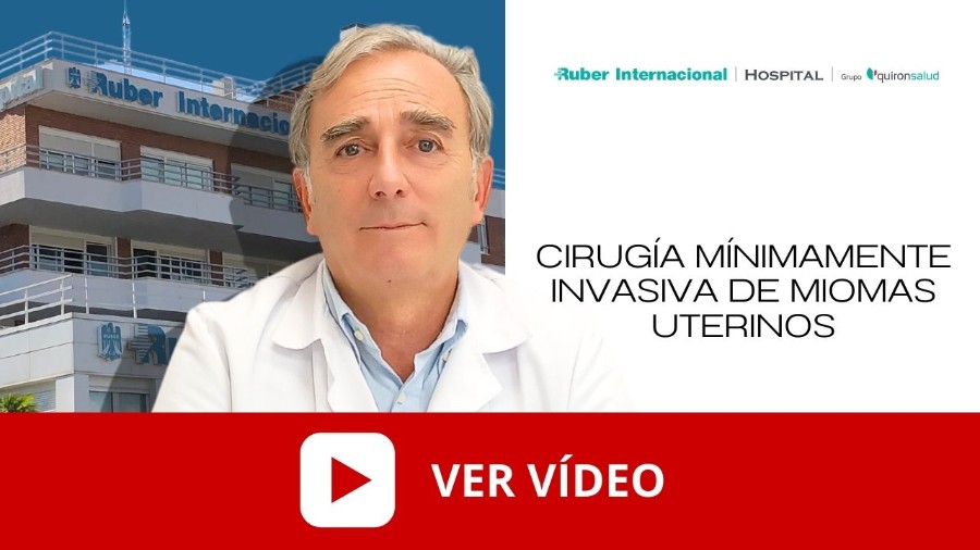Miomas uterinos: síntomas, diagnóstico y tratamientos avanzados