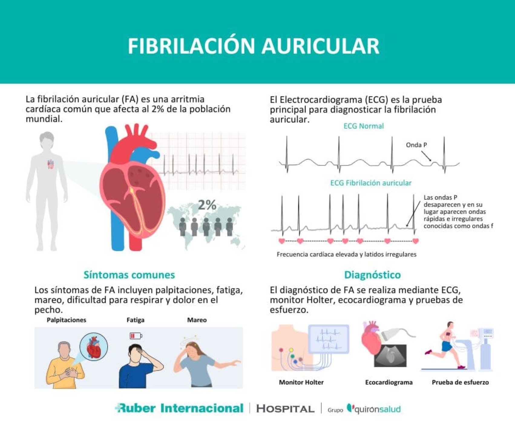 Tratamiento de la Fibrilación Auricular: Cierre de la orejuela ...