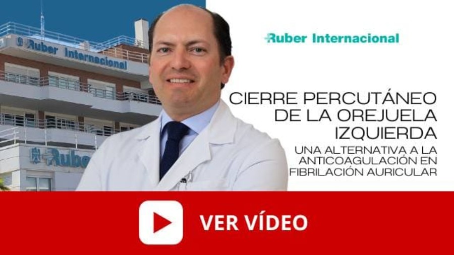 Tratamiento de la Fibrilación Auricular: Cierre de la orejuela ...
