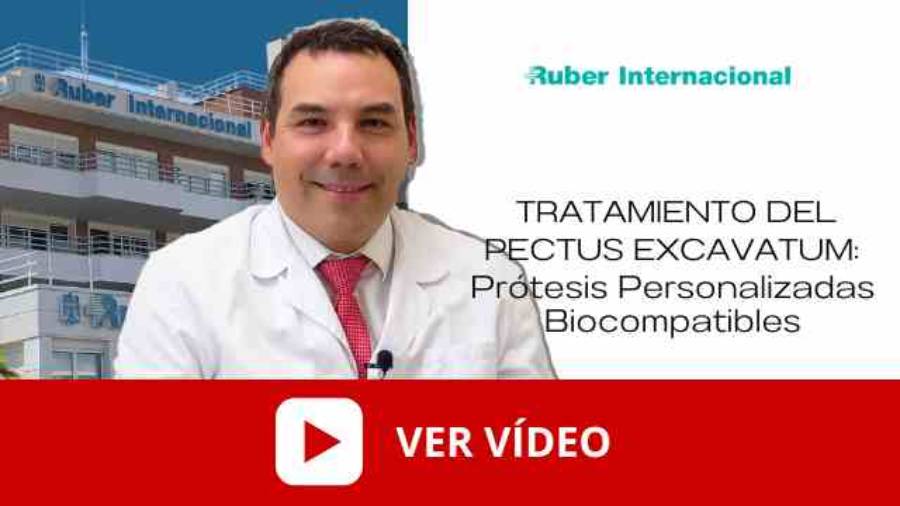 Pectus Excavatum: Tratamiento con Protesis Personalizadas Biocompatibles