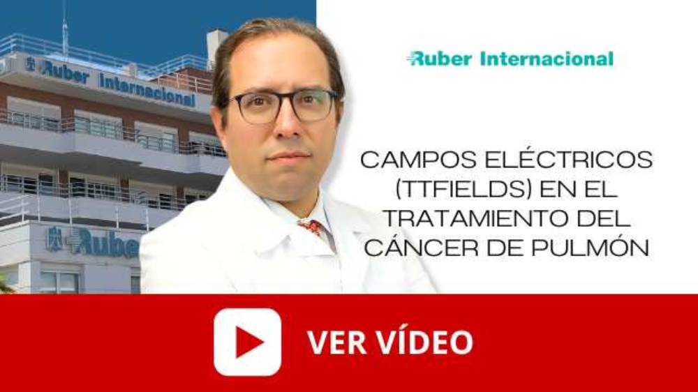 Campos eléctricos (TTFields) en el tratamiento del cáncer