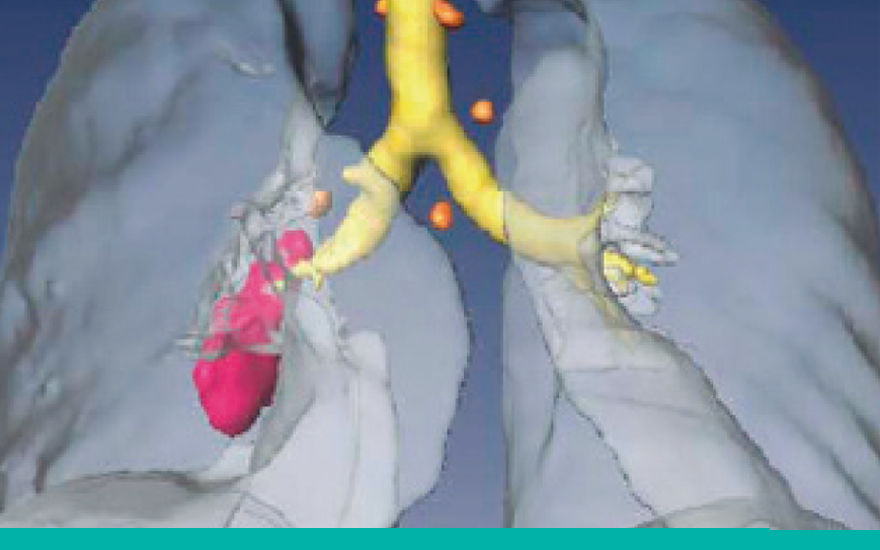 ¿Cómo afecta el tabaco a los pulmones? | Hospital Quirónsalud Córdoba