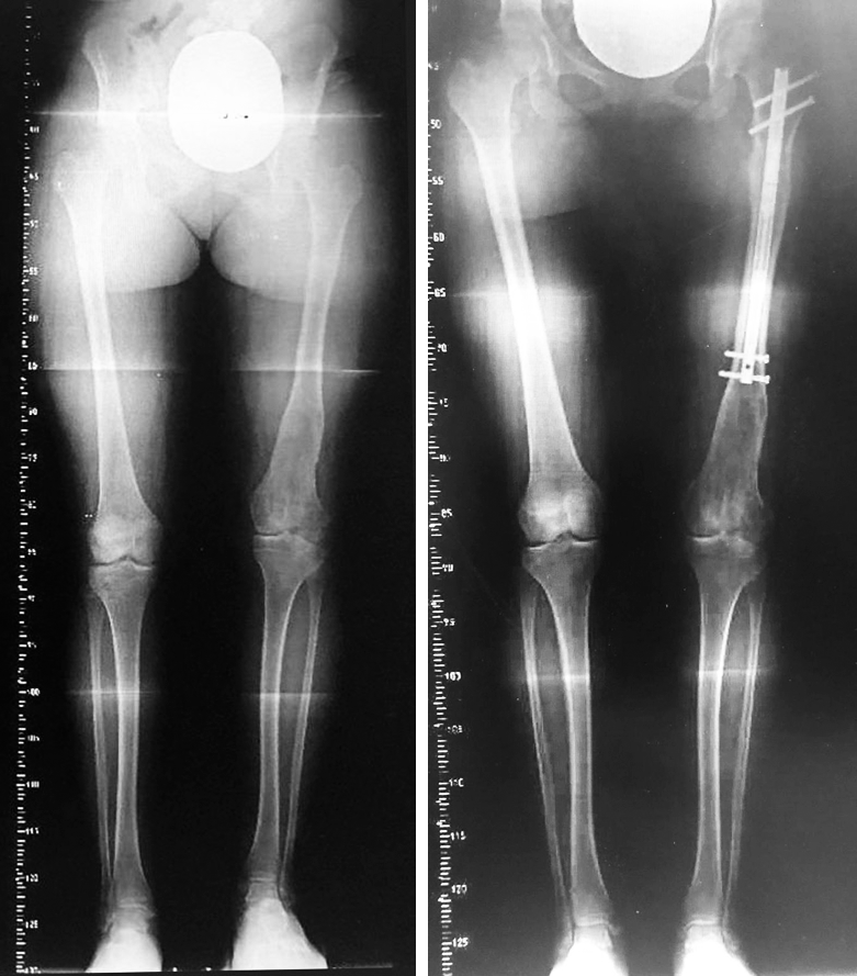Desalineaciones y Dismetrías | Hospital Quirónsalud Málaga