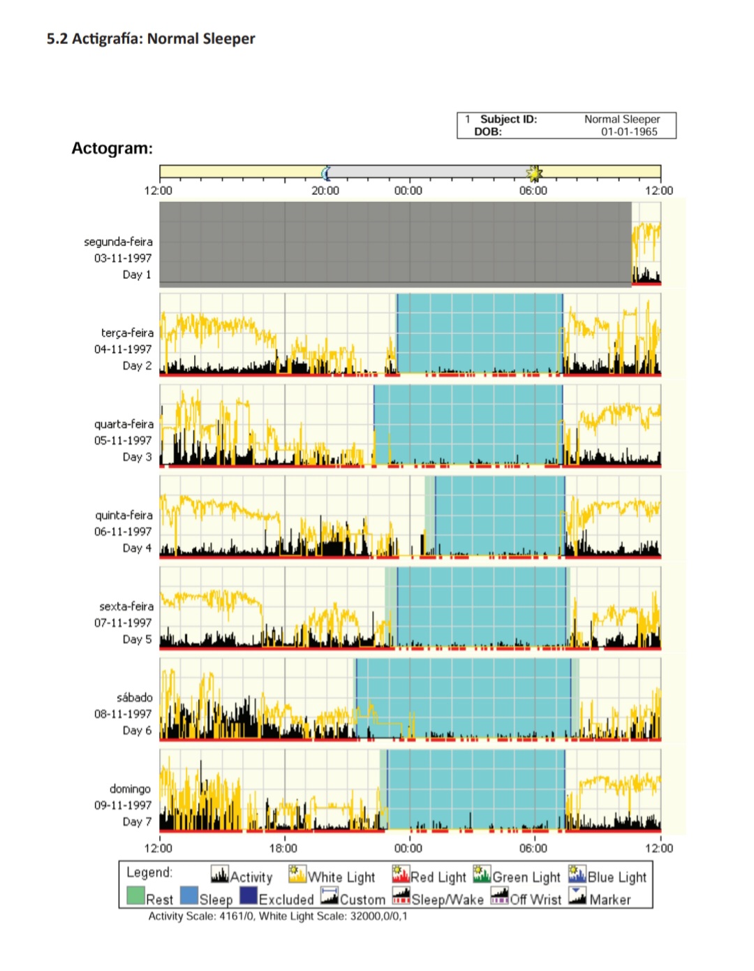 La actigrafía: una herramienta útil en las Unidades de sueño | Blogs ...
