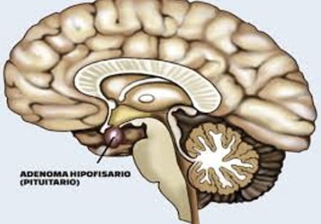 Enfermedad de Cushing | Blogs Quirónsalud