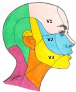 Cefalea neuralgiforme unilateral de breve duración | Blogs Quirónsalud