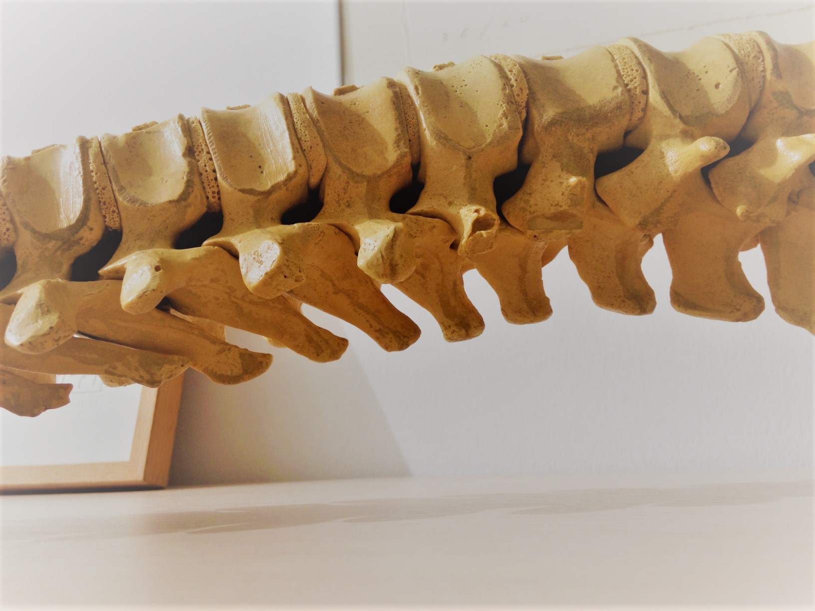 Unitat de Columna | Hospital Quirónsalud Barcelona