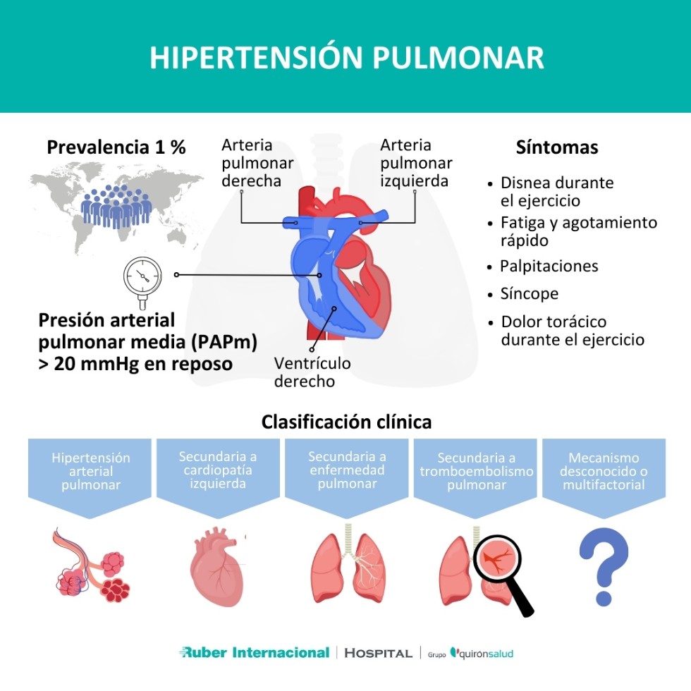 Hipertensión Pulmonar: Síntomas, diagnóstico y tratamiento